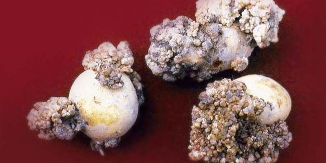 26 Turkish Provinces Quarantined due to Potato Disease Detection ...